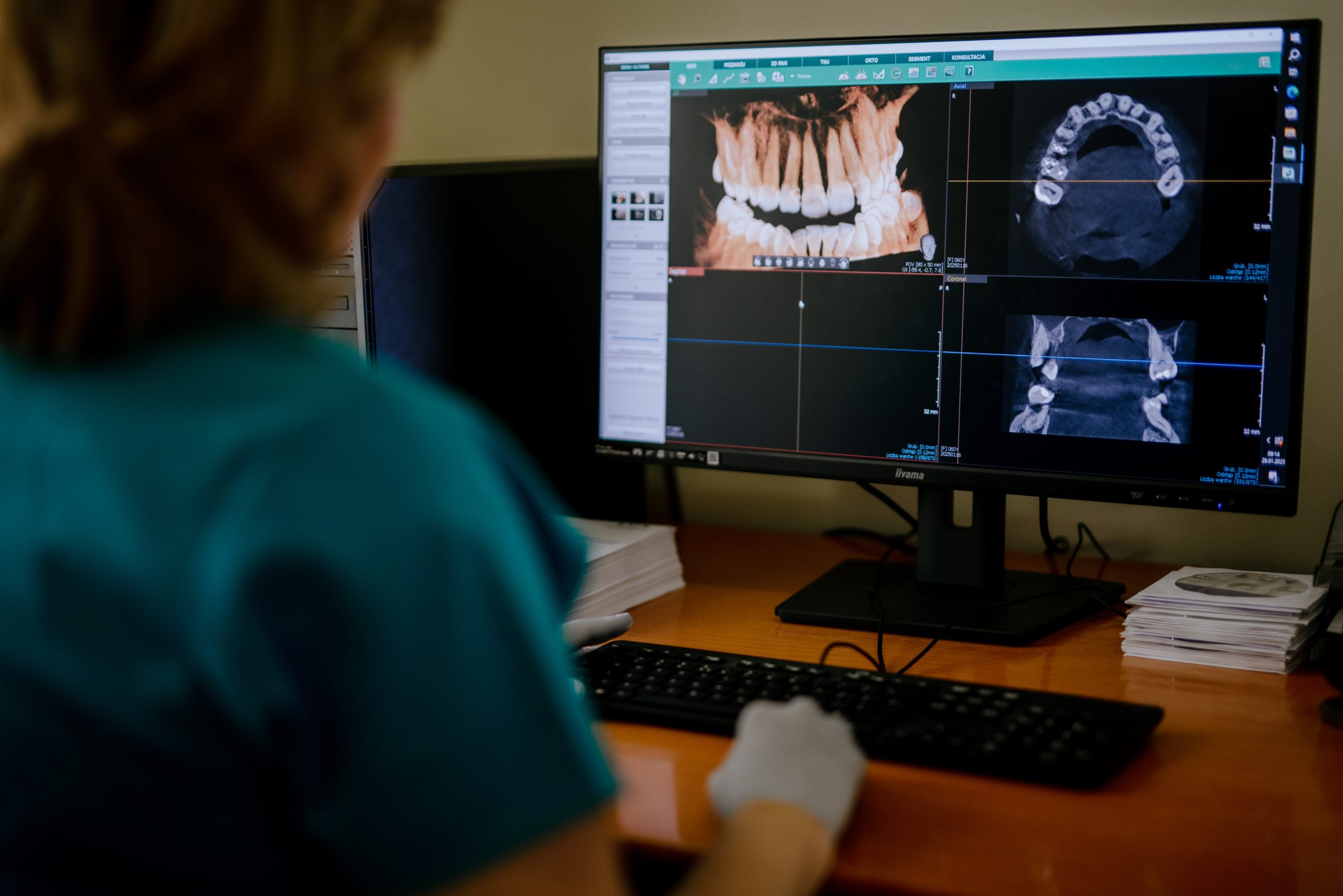 Rentgen stomatologiczny - Vita Medical